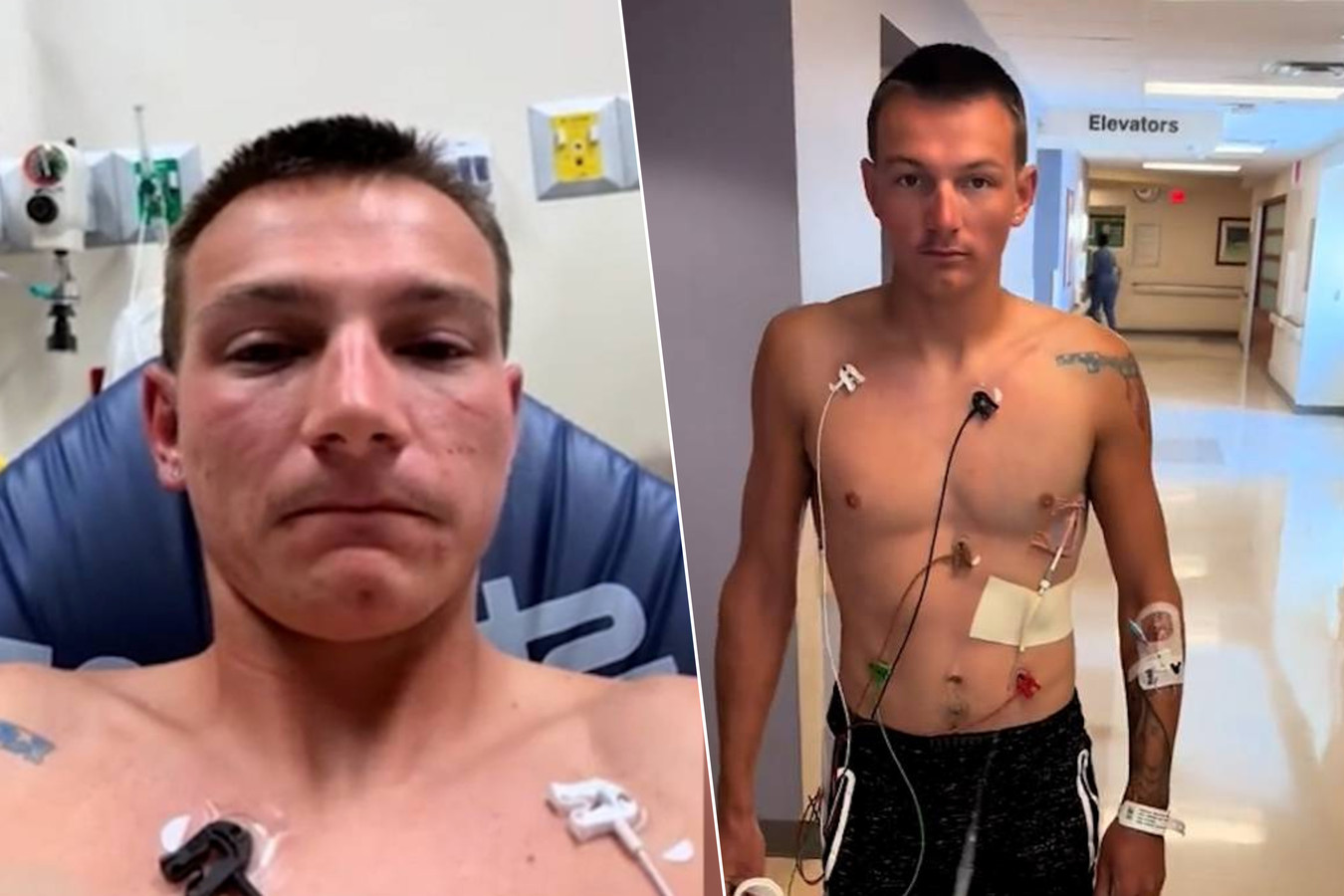 Tiener (19) rookt gat in longen door overmatig vapen: “Elke 3 tot 5 ...