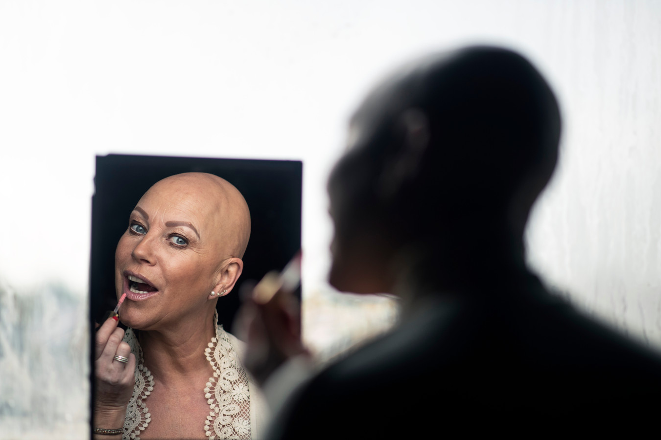 Jessica was 34 toen ze kaal werd: ‘In de kroeg deed ik mijn pruik af ...