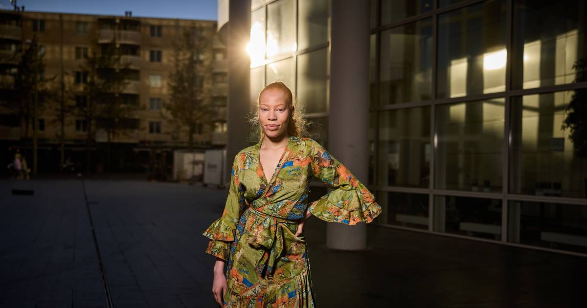 Latifa ontvluchtte Congo om haar uiterlijk toen ze baby was, nu breekt ...