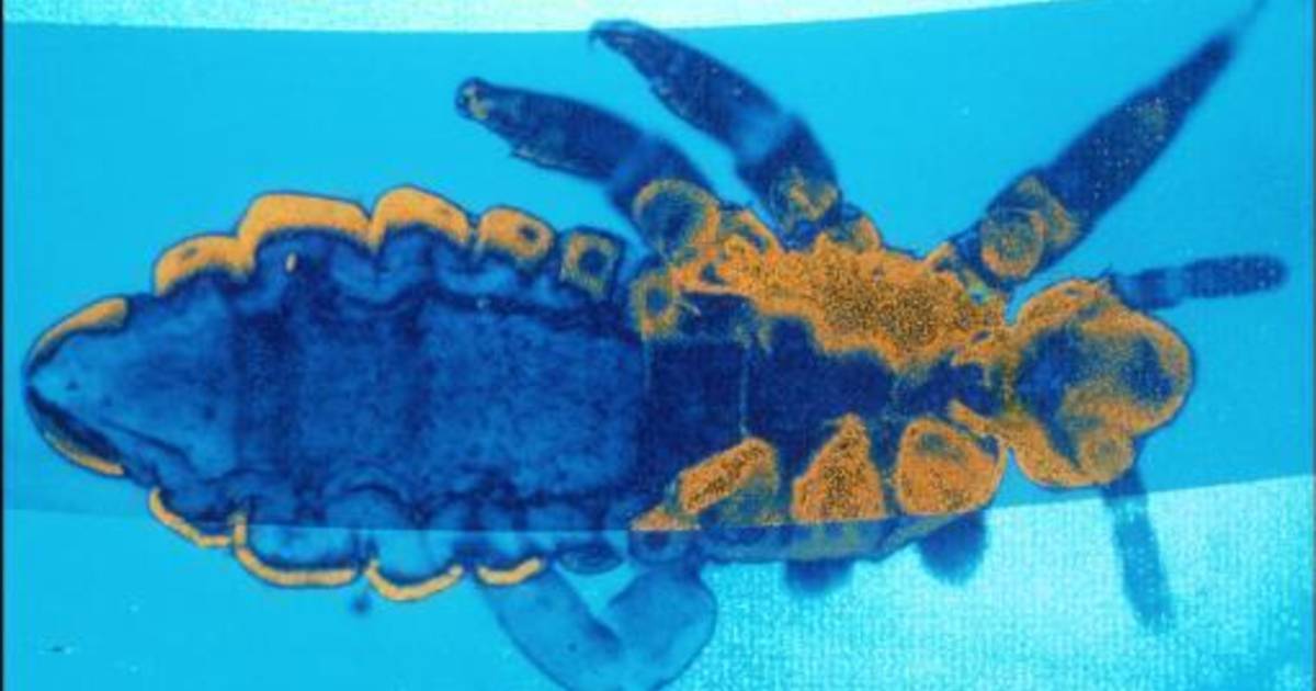 Quand la brigade anti-poux débarque à l'école | Belgique | 7sur7.be