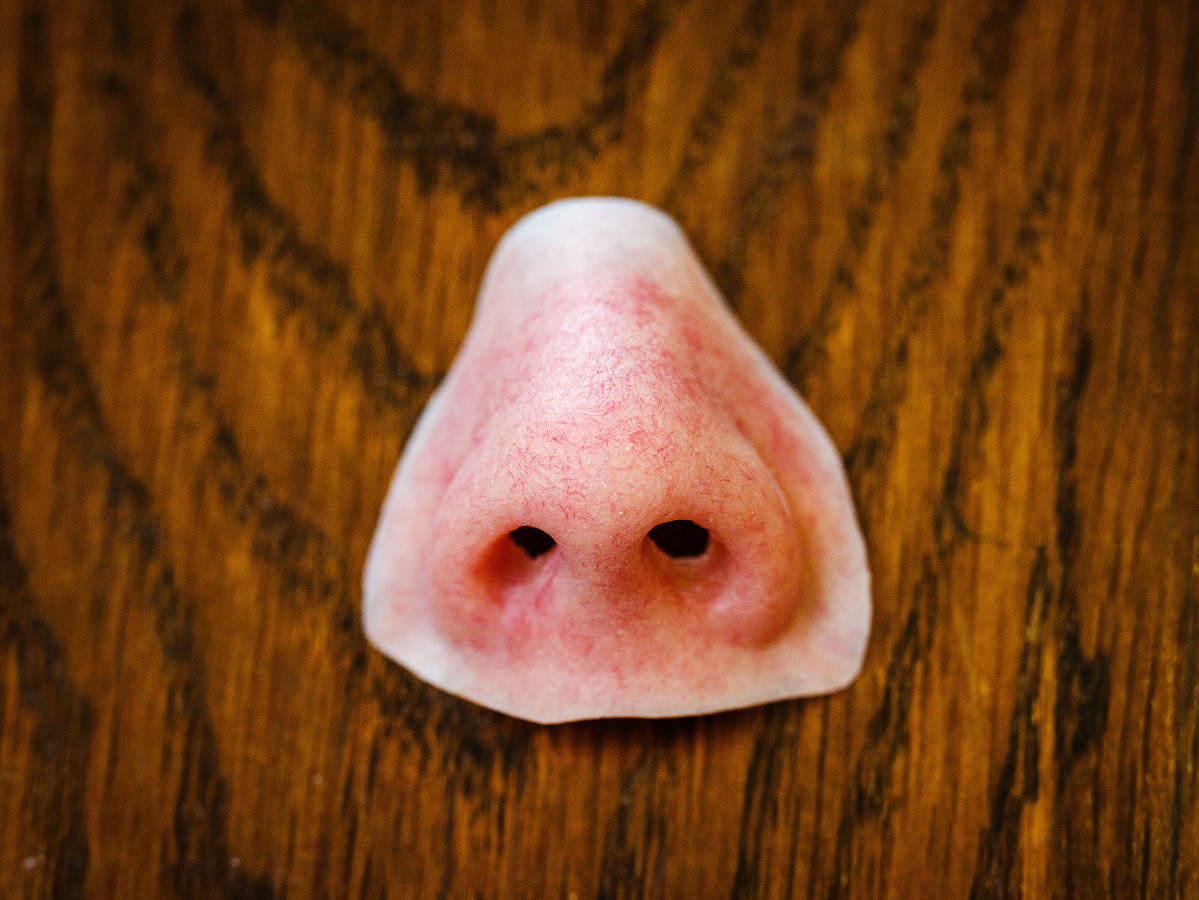 Esther kreeg net als Dieuwertje Blok een nieuwe neus: ‘Het heeft weken ...