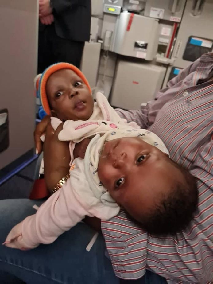 Siamese tweeling uit Congo met succes gescheiden in Kinderziekenhuis ...