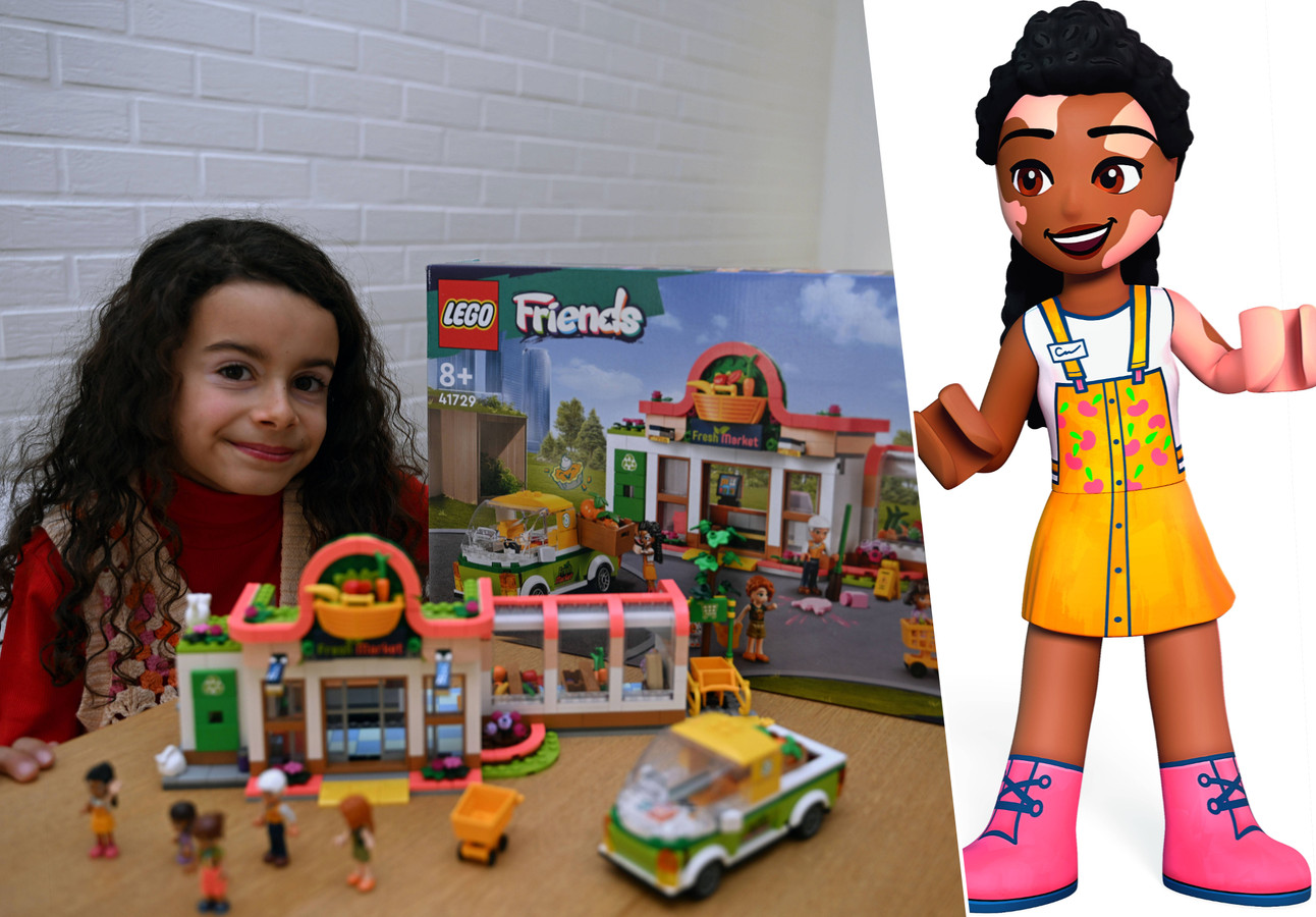 "Maman, regarde... C'est moi!": atteinte de vitiligo, Emily est devenue ...