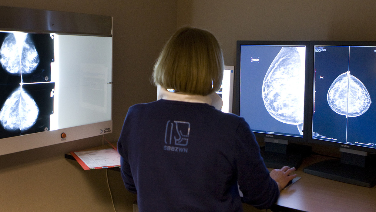 Meer patiënten sterven aan borstkanker na amputatie | Het Parool