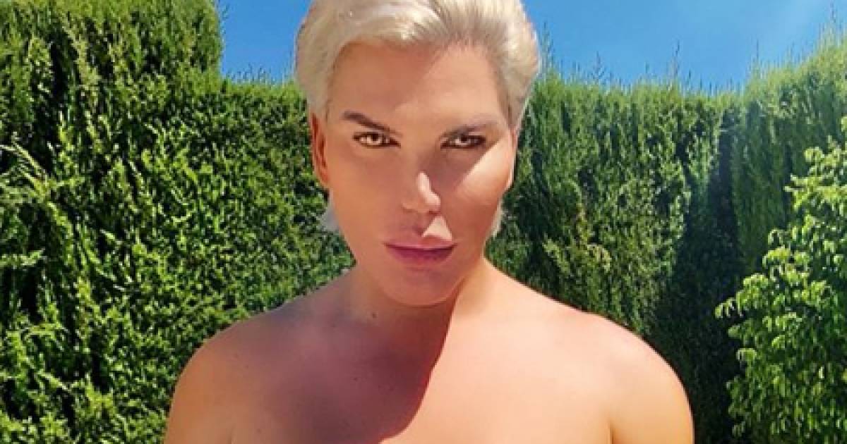 'Faceliftfreak' Rodrigo baalt van laten verwijderen vier zwevende ...