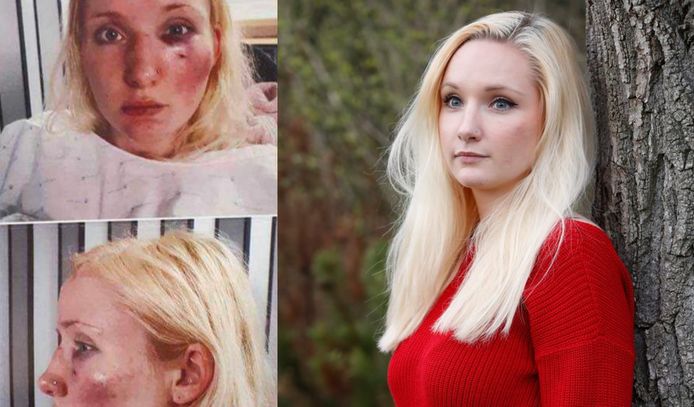 Temptation Island-deelneemster Laura werd zwaar mishandeld ‘door boze ...