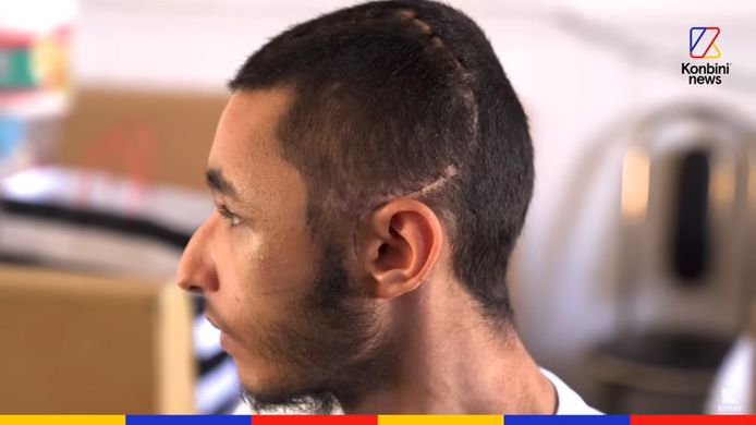 Affaire Hedi: le policier mis en cause a reconnu un tir de LBD, son ...