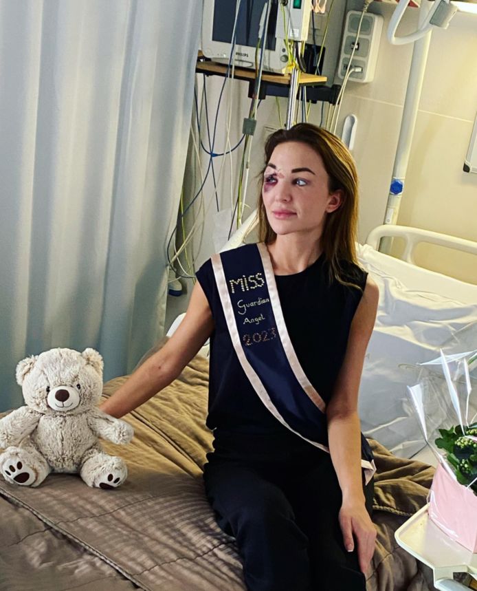 Miss België Chayenne toont voor het eerst zwaar toegetakeld gezicht na ...