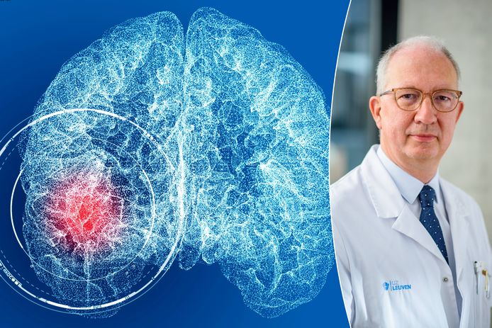 Hoe herken je een aneurysma? “1 op de 100 Belgen heeft het”