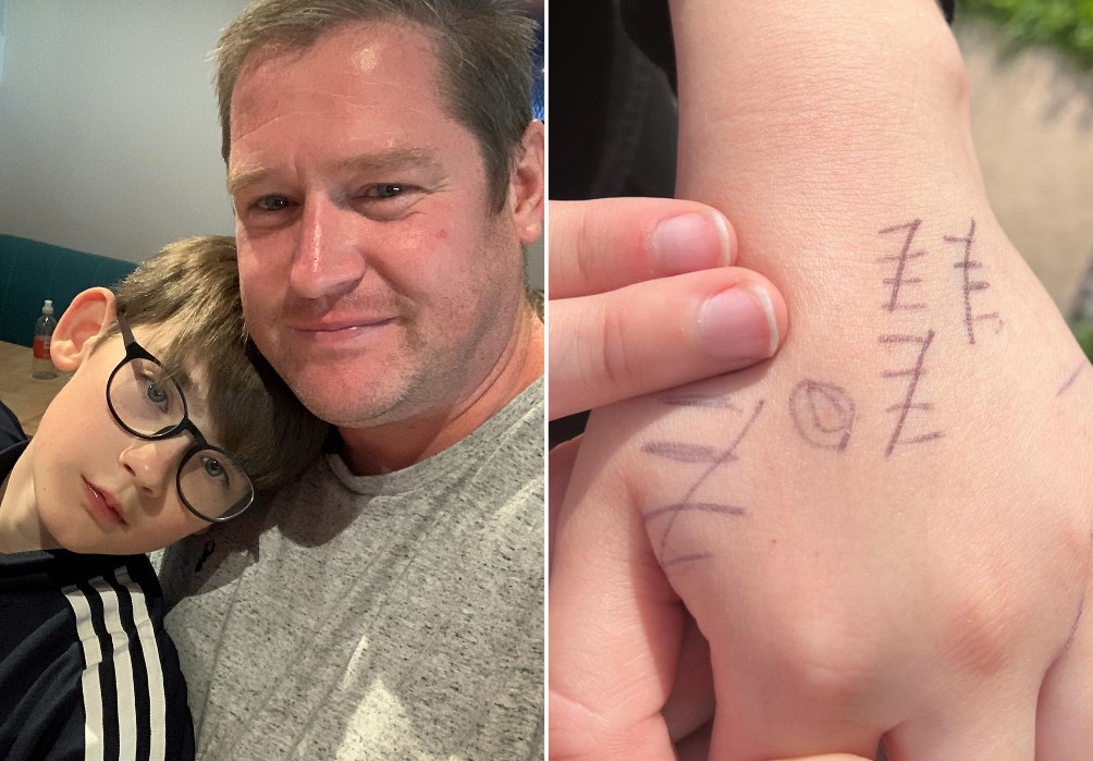 Britse vader deelt aangrijpende foto van gepeste zoon: “Streepjes op ...
