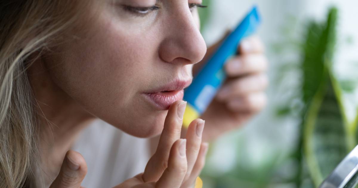Droge en gebarsten lippen? Dit helpt volgens dermatologen het beste ...