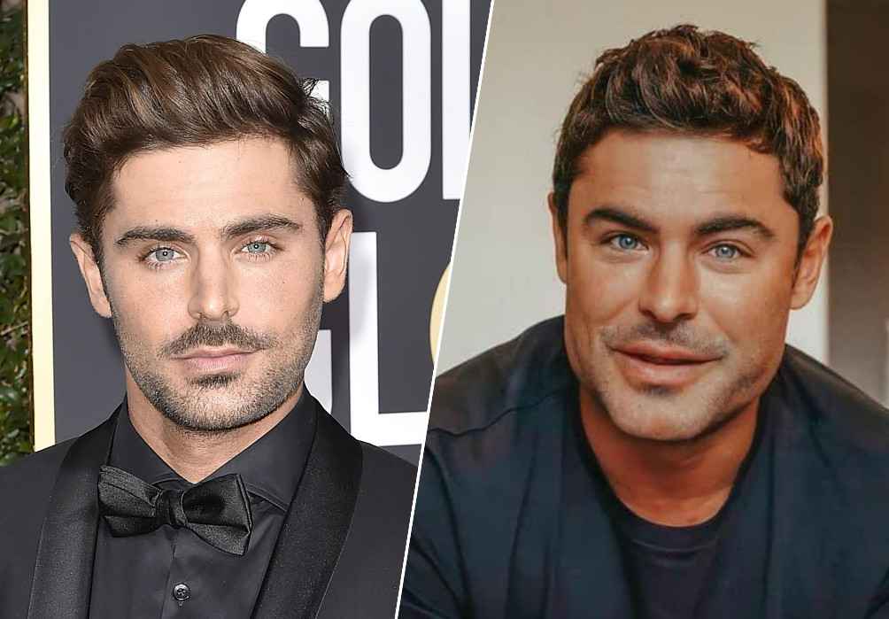 Chirurgie esthétique? Zac Efron dévoile enfin la vraie raison de sa ...