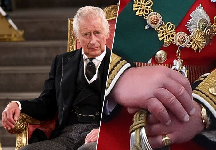 Heeft koning Charles hartproblemen? Bezorgdheid over gezwollen vingers ...