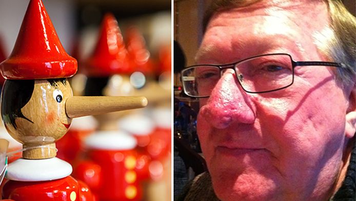 Hans (68) heeft al 5 jaar lang de grootste neus ter wereld | Bizar | hln.be