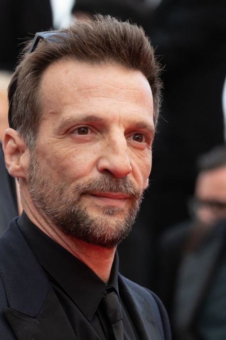Mathieu Kassovitz montre ses blessures après son accident de moto: “Je ...