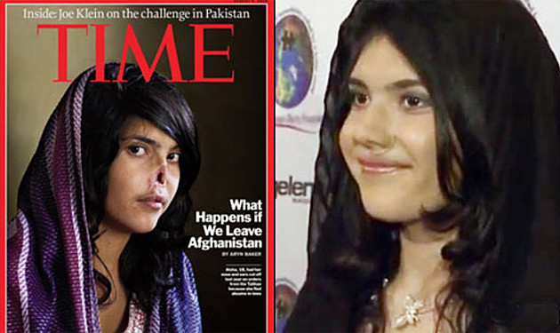 Afghaanse met afgehakte neus: 'Echte strijd begint nu pas' | Foto | AD.nl