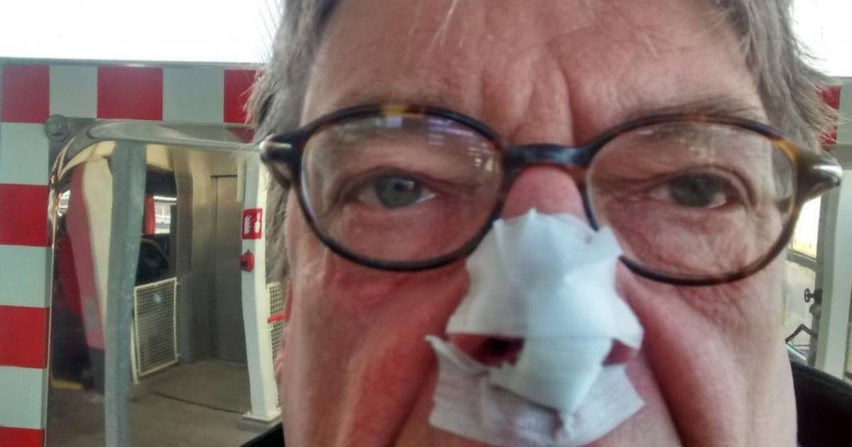 Huidkanker van neus Henk Westbroek weggehaald | Show | AD.nl