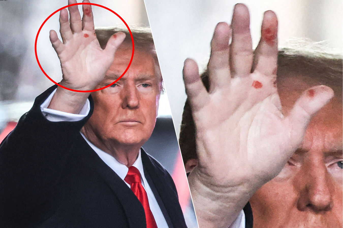 La réponse de Trump aux mystérieuses marques rouges sur sa main droite ...