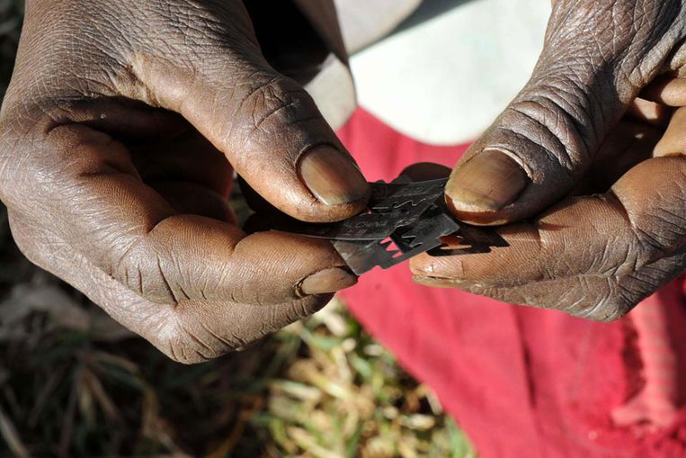 Ophef in VS over advies vrouwenbesnijdenis | De Volkskrant