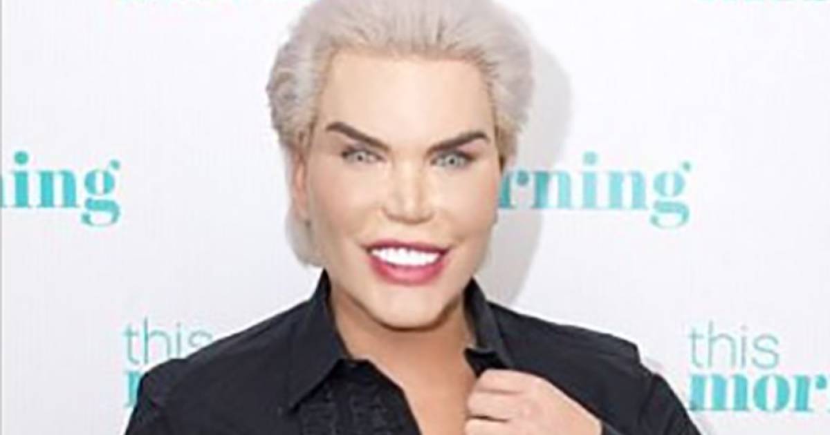 'Faceliftfreak' Rodrigo laat vier ribben weghalen om beter in colberts ...