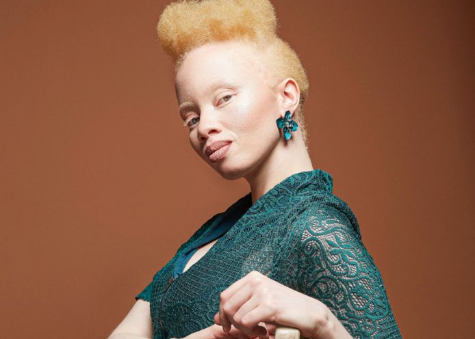 Jurist en model Thando Hopa (31) komt op voor mensen met albinisme ...