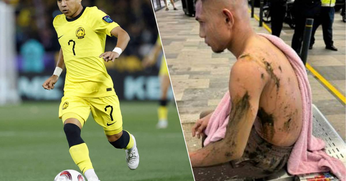 Maleisisch international zwaargewond na aanval met bijtend zuur, zijn ...