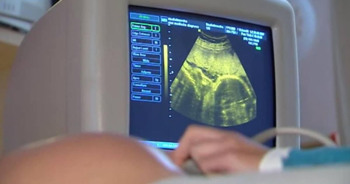 Meer baby's met afwijking in Antwerpen | Fit & Gezond | hln.be