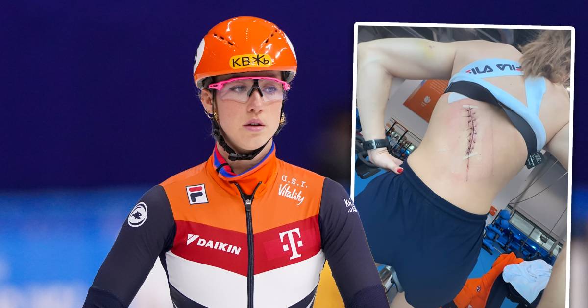 Suzanne Schulting deelt beelden van haar enorme snijwond en is alweer ...