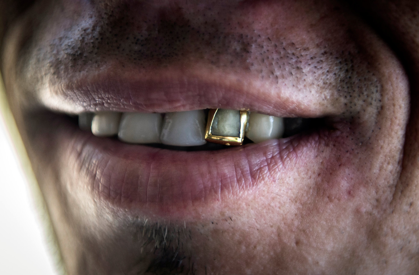 Man met gouden tand bedreigt pompbediende met mes | Foto | AD.nl