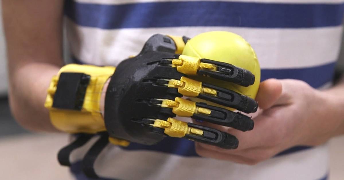 Des lycéens fabriquent une prothèse de main pour leur camarade | Monde ...