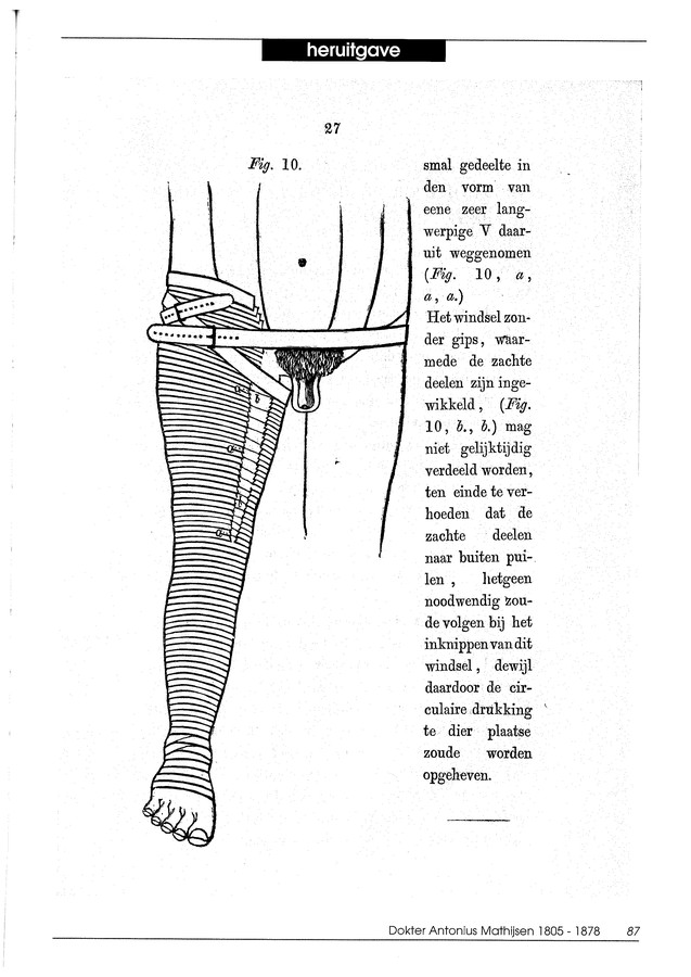 Budelse uitvinder brak pootjes van levende kippen om zijn gipsverband ...