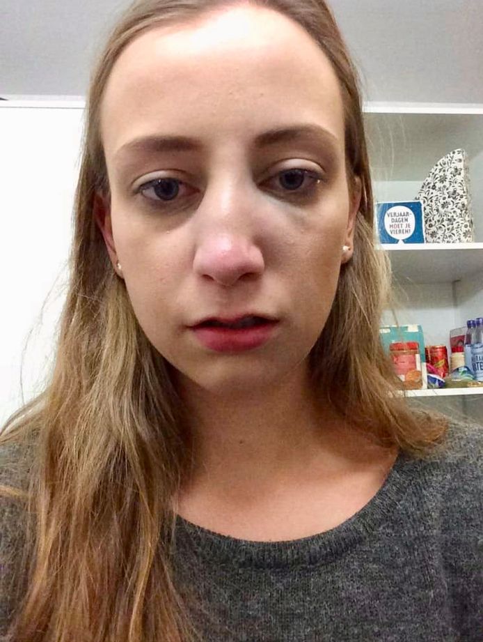 Kotstudente (20) die klappen kreeg op café in Leuven zoekt getuigen ...