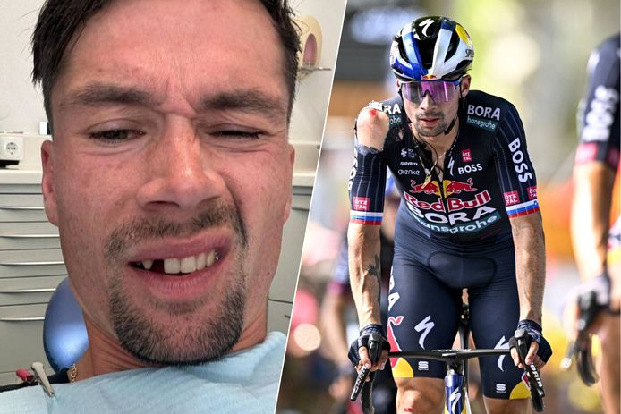 Pech blijft Primoz Roglic achtervolgen: na problemen met de rug ...