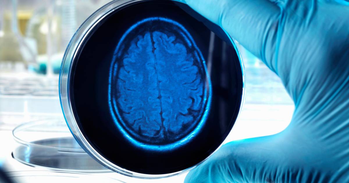 blood-test-can-detect-alzheimer-s-faster-important-step-forward