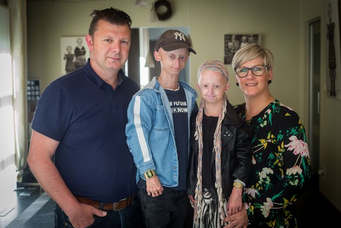 Progeriapatiënt Mats Palinckx (17) overleden | Kapellen | hln.be