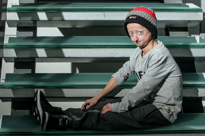 Nieuw medicijn verlengt leven progeriapatiënt Michiel met 2 jaar ...