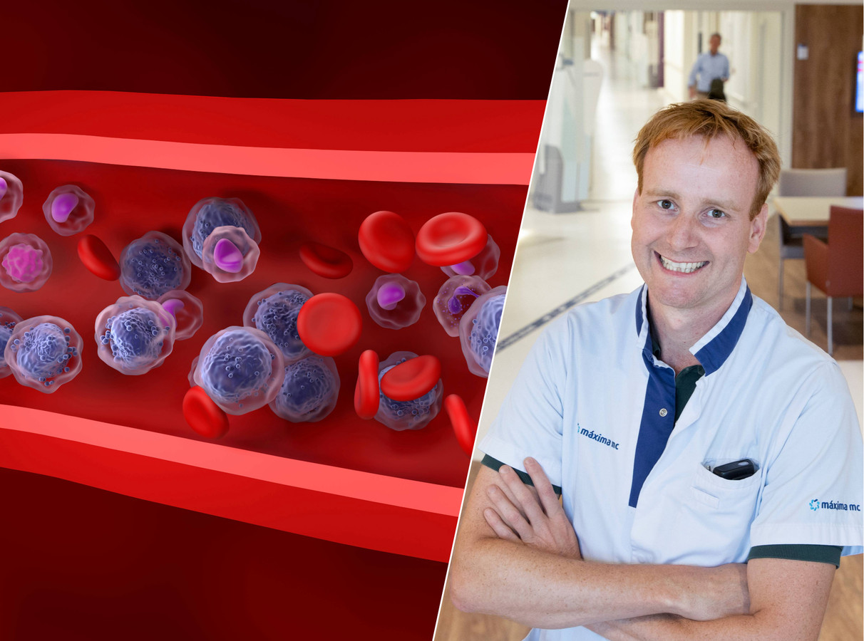 Zo’n 900 Nederlanders krijgen jaarlijks diagnose acute leukemie: dit ...