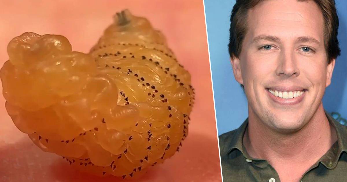 KIJK. Nederlandse tv-bioloog Freek Vonk “bevallen” van larf in zijn ...