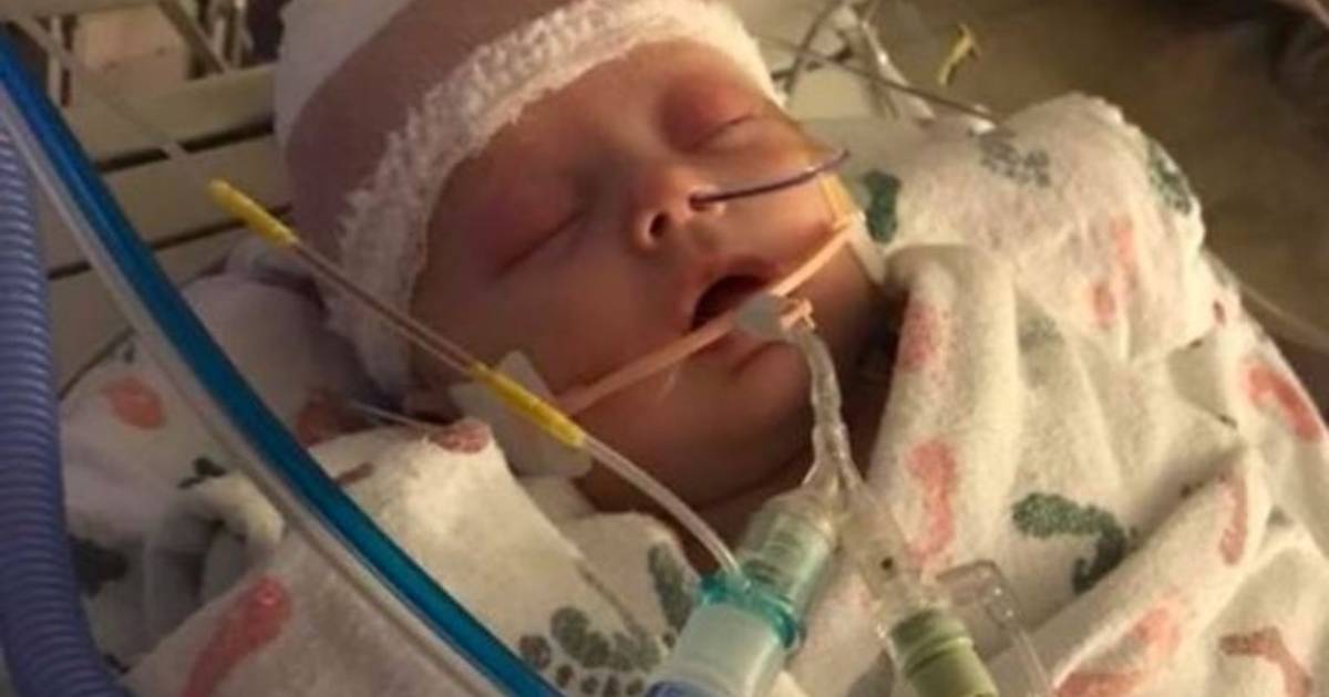 Baby levensgevaarlijk gewond nadat ze verdwaalde honkbal tegen haar ... Baby levensgevaarlijk gewond nadat ze verdwaalde honkbal tegen haar ...