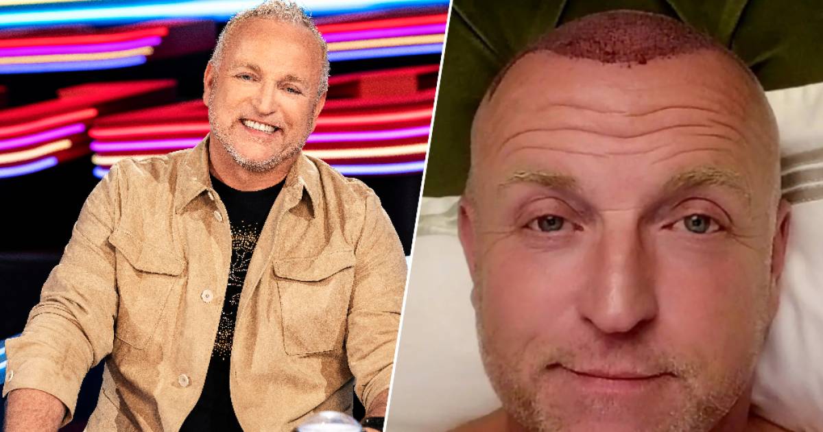 Gordon ondergaat haartransplantatie: “Happy New Hair!” | Showbizz | hln.be