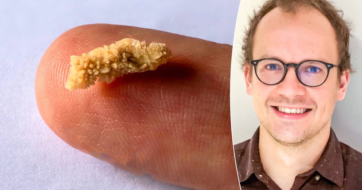 “Pijn is te vergelijken met weeën bij een bevalling”: hoe herken je ...