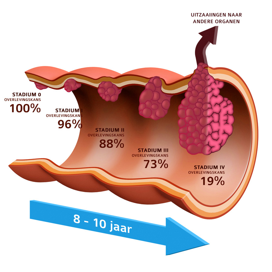 Dokter Koen Thorrez geeft infosessie over dikkedarmkanker | Foto | hln.be