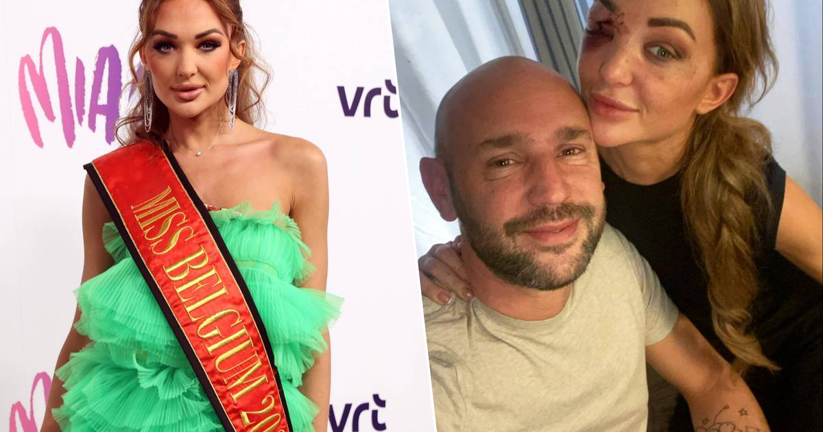 Ex-Miss België Chayenne Van Aarle is opnieuw single: “Dat ongeval heeft ...