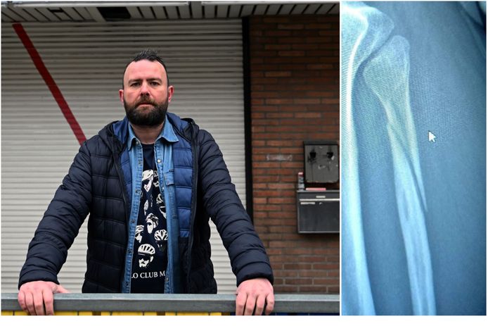 Bert (42) kent hangjongeren die hem gebroken been stampten, toch wordt ...