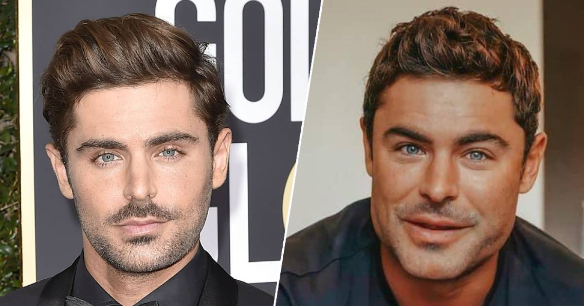 Chirurgie esthétique? Zac Efron dévoile enfin la vraie raison de sa ...