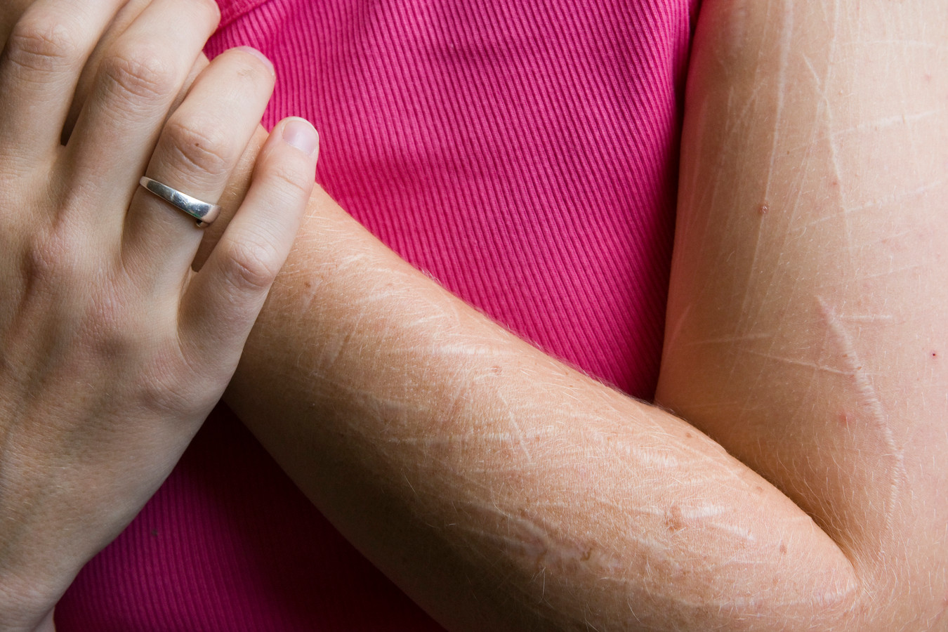 Altijd liegen en draaien: Tamara kampte met borderline, maar is nu ...