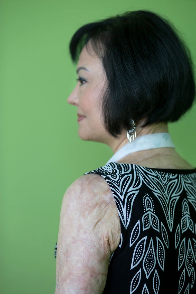 Hoe de foto van napalmmeisje Kim Phuc van een vloek tot een zegen werd