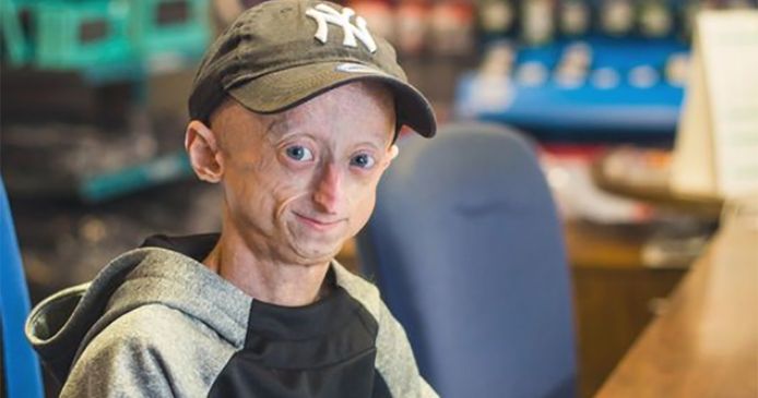 Nieuw medicijn verlengt leven progeriapatiënt Michiel met 2 jaar ...