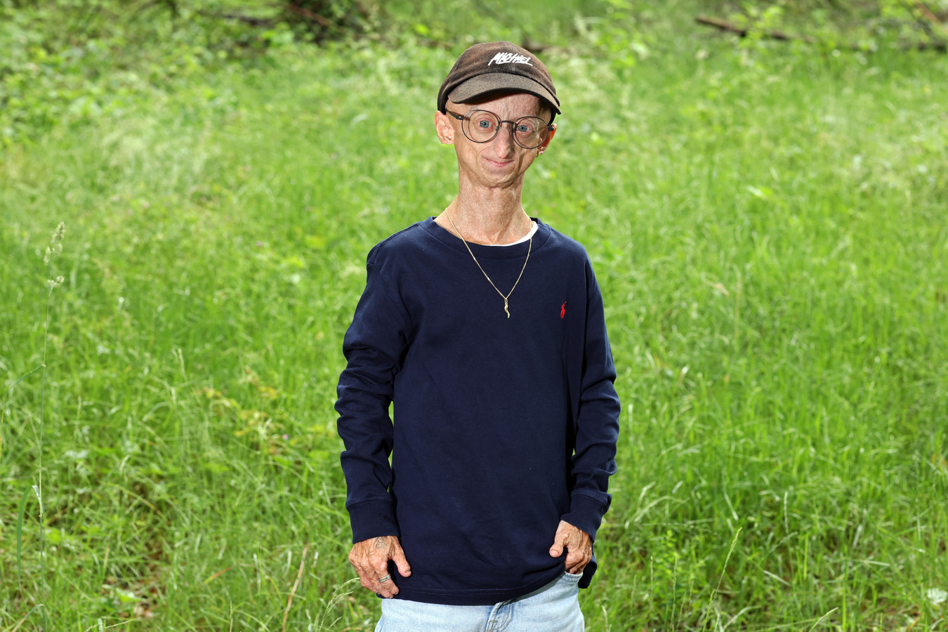 Progeriapatiënt Michiel wordt 24, dubbel zo oud als de dokters ...